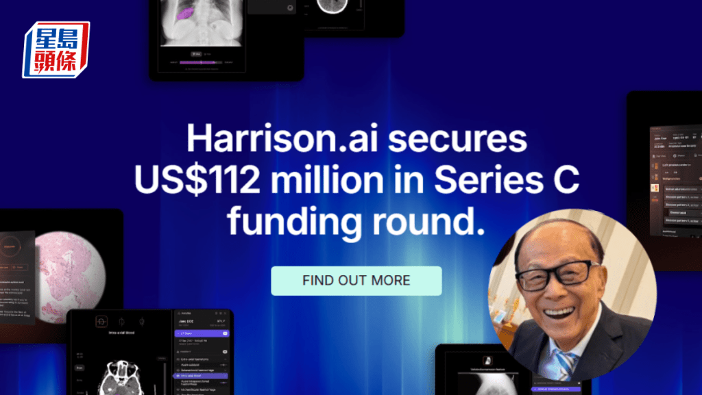 Harrison.ai完成近9億融資 維港投資有份領投 港急症室CT腦掃描已應用技術