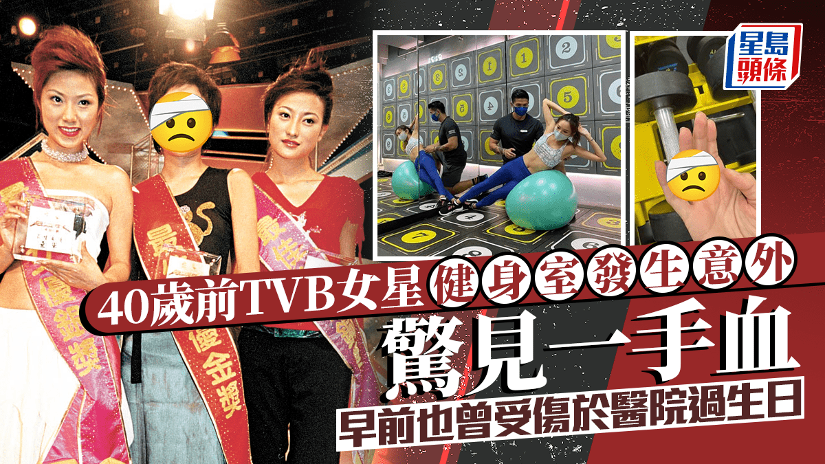 40歲前TVB女星健身室發生意外驚見一手血 「豆腐人」體質曾拍節目導致肌肉筋膜撕裂