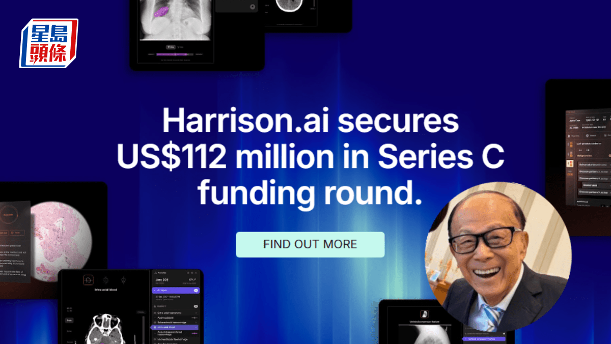 Harrison.ai完成近9億融資 維港投資有份領投 港急症室CT腦掃描已應用技術