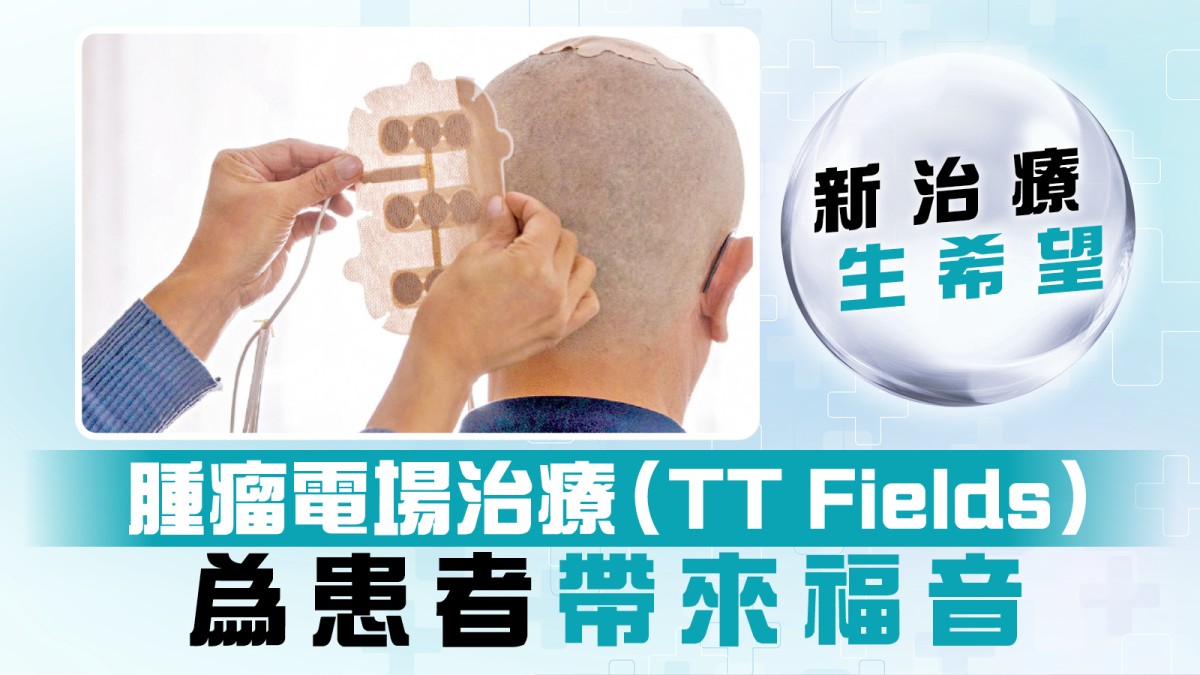 新治療 生希望 腫瘤電場治療（TT Fields）為患者帶來福音