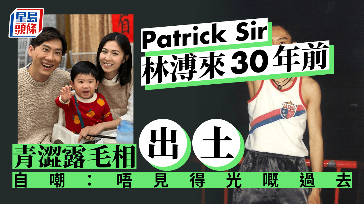 Patrick Sir林溥來30年前青澀露毛相出土 自嘲：唔見得光嘅過去