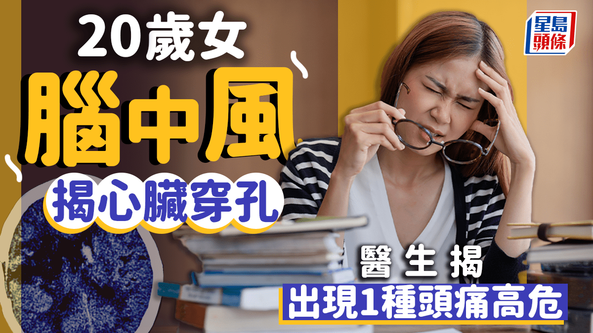 中風症狀｜20歲女腦中風揭心臟穿孔 醫生揭1類頭痛患者風險高